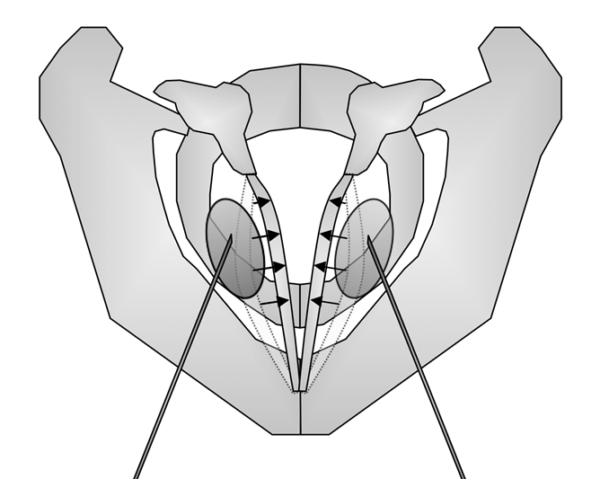 Augmentation | MEDICAL VOICE CENTER