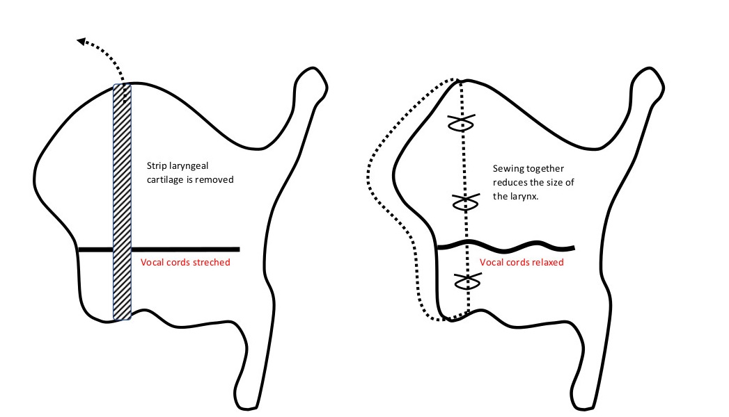 Voice Deepening | MEDICAL VOICE CENTER